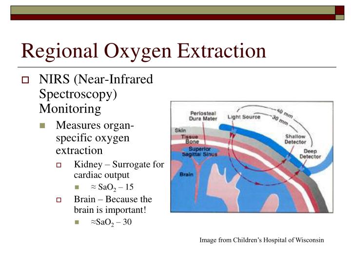 PPT - Oxygen Delivery PowerPoint Presentation - ID:5142415