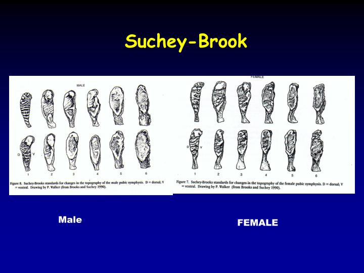 PPT - Comparison between various methods of age estimation in skeletal ...