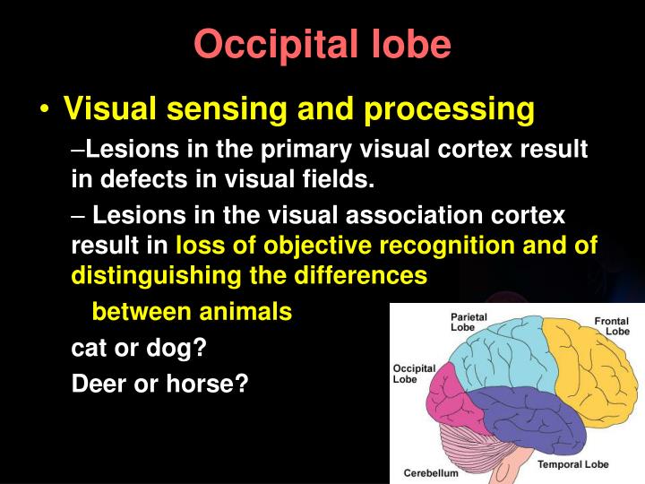 PPT - Brain dysfunction PowerPoint Presentation - ID:5150644
