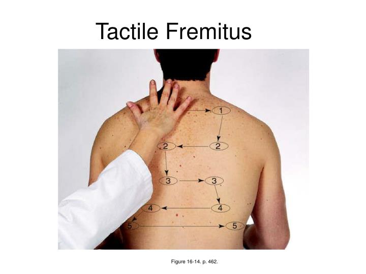 PPT - Physical Exam of the Chest: Auscultation PowerPoint Presentation ...