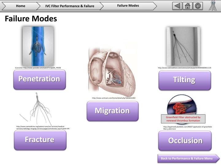 PPT - Inferior Vena Cava Filters (IVCFs) PowerPoint Presentation - ID ...