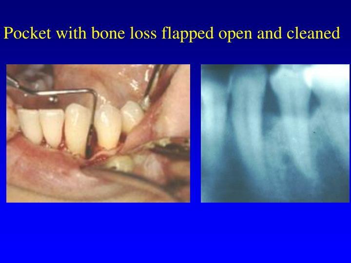 PPT - What is periodontal disease? How does it affect diabetes ...