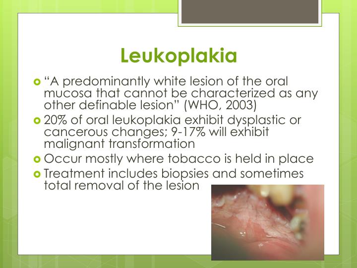 PPT - Oral Health and Tobacco Use PowerPoint Presentation - ID:5168282