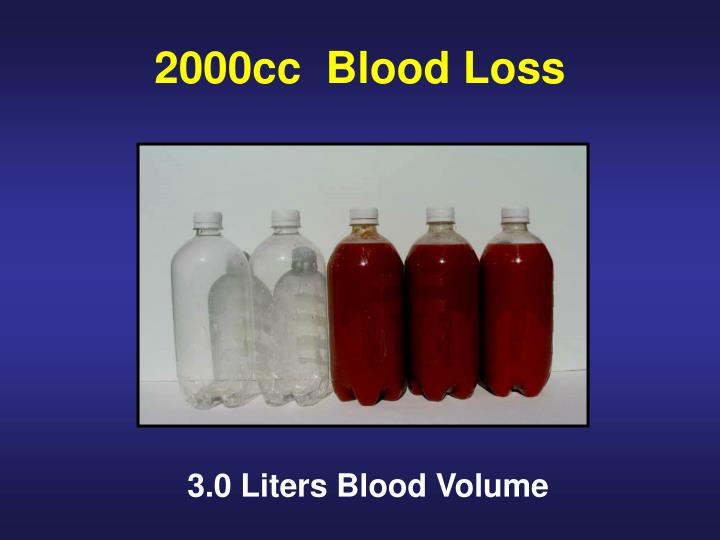 PPT - Controlling Bleeding PowerPoint Presentation - ID:5170566
