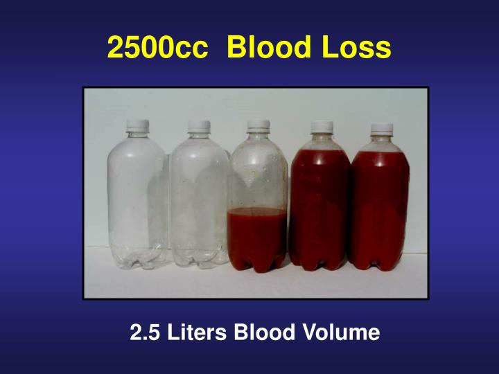 PPT - Controlling Bleeding PowerPoint Presentation - ID:5170566