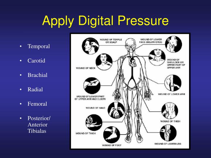 PPT - Controlling Bleeding PowerPoint Presentation - ID:5170566