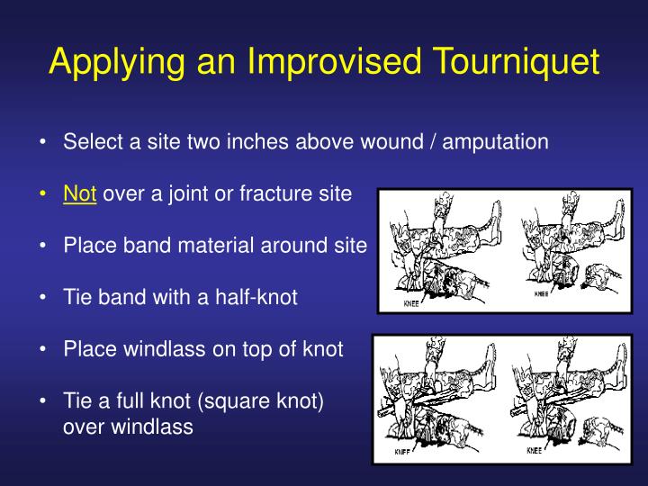 PPT - Controlling Bleeding PowerPoint Presentation - ID:5170566