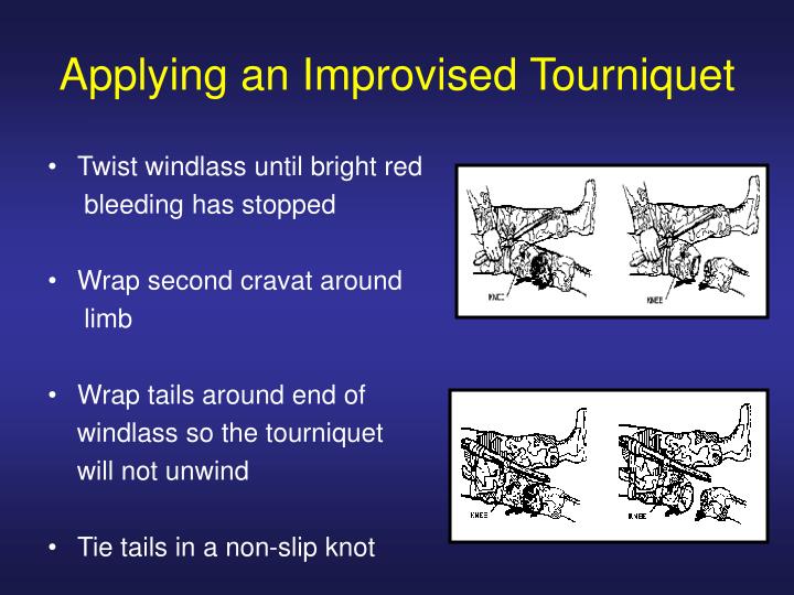PPT - Controlling Bleeding PowerPoint Presentation - ID:5170566