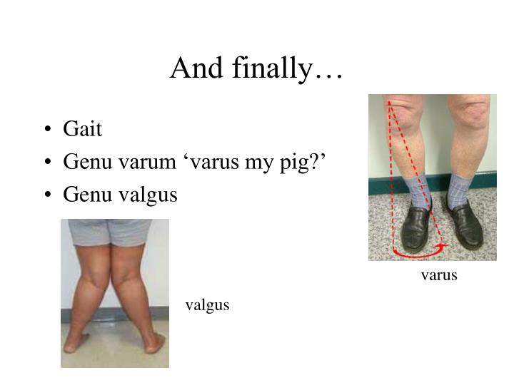 PPT - Knee Examination PowerPoint Presentation - ID:5175948