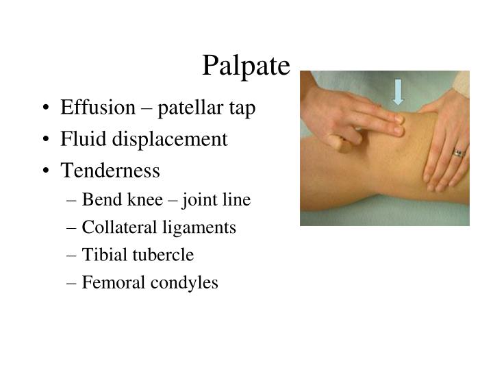 PPT - Knee Examination PowerPoint Presentation - ID:5175949