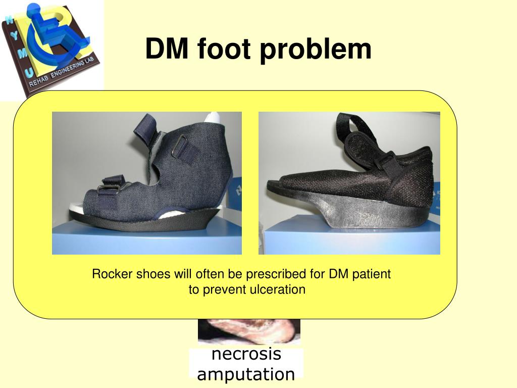 PPT - CENTER OF PRESSURE ON DIABETIC SUBJECTS WITH ROCKER SOLE SHOES ...