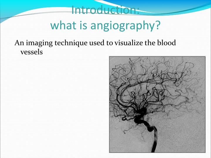 PPT - Angiography PowerPoint Presentation - ID:5177574