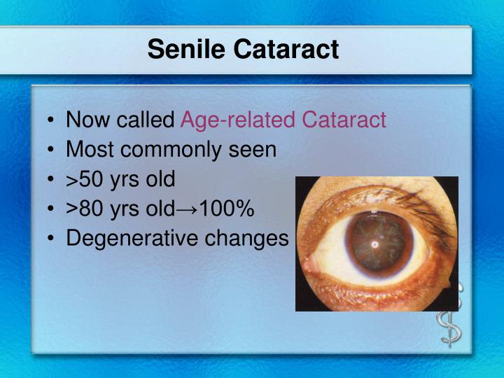 PPT - Lens Disease PowerPoint Presentation - ID:5180104