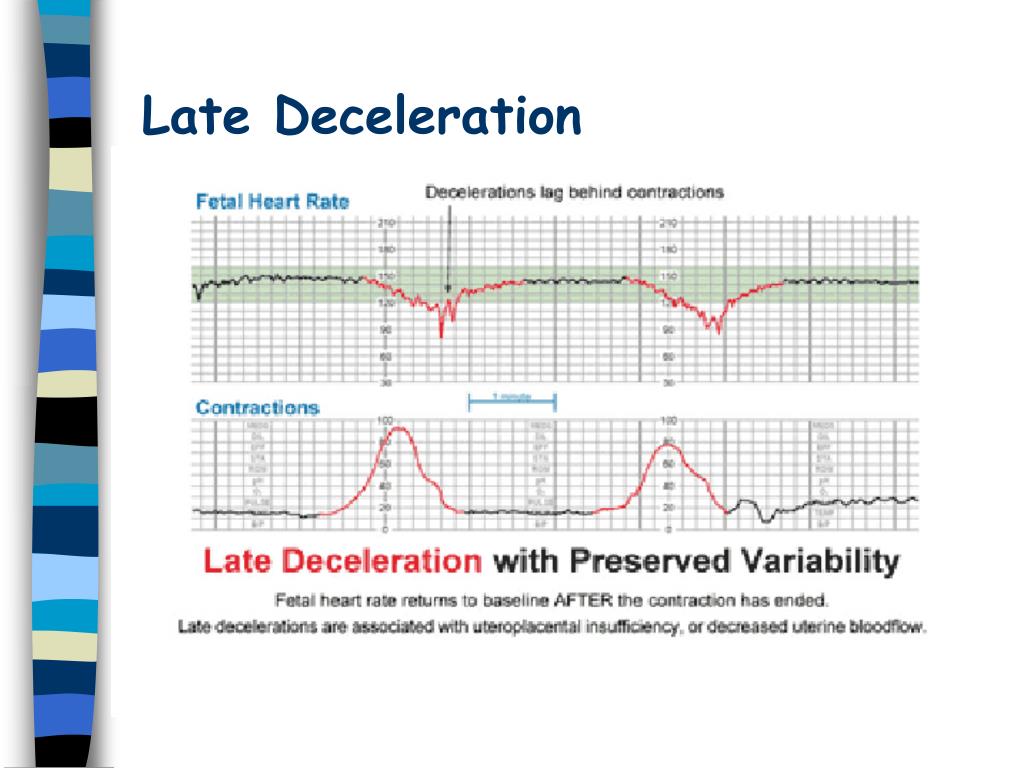 Ppt Fetal Monitoring Powerpoint Presentation Free Download Id 5180473