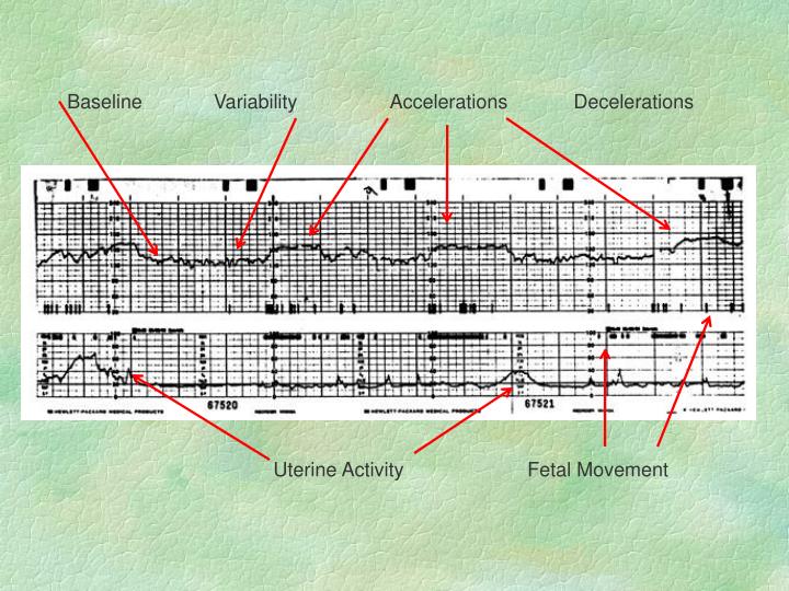 PPT - Antepartum Fetal Surveillance ‘HELLO BABY, HOW ARE YOU ...