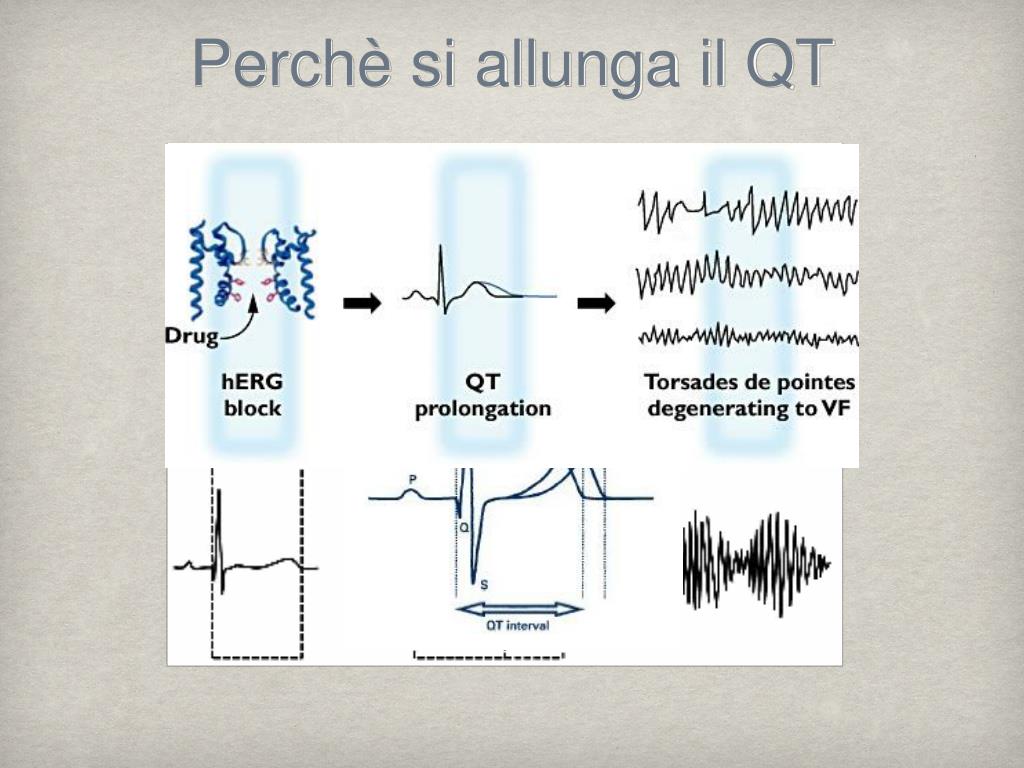 PPT - Il QT e QT c PowerPoint Presentation, free download - ID:5182933 PPT - Il QT e QT c PowerPoint Presentation, free download - ID:5182933