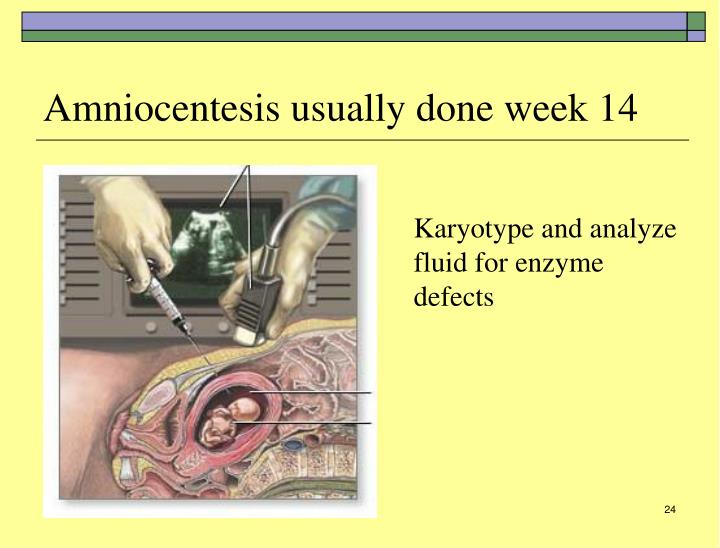 PPT - Chromosome Theory of Inheritance PowerPoint Presentation - ID:5183654