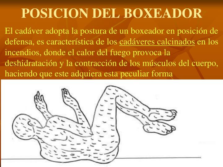 PPT - RECONOCIMIENTO TANATOLÓGICO FORENSE PowerPoint Presentation - ID ...