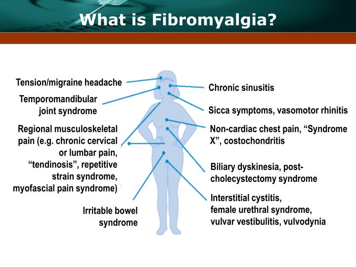 PPT - Fibromyalgia & Soft Tissue Rheumatism PowerPoint Presentation ...