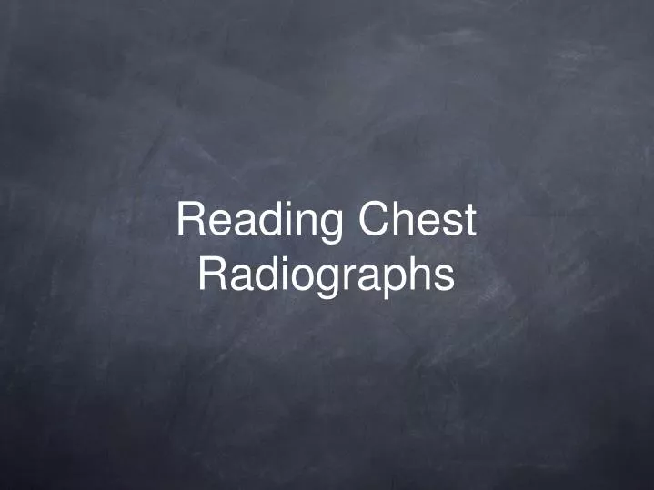 PPT - Reading Chest Radiographs PowerPoint Presentation, free download ...
