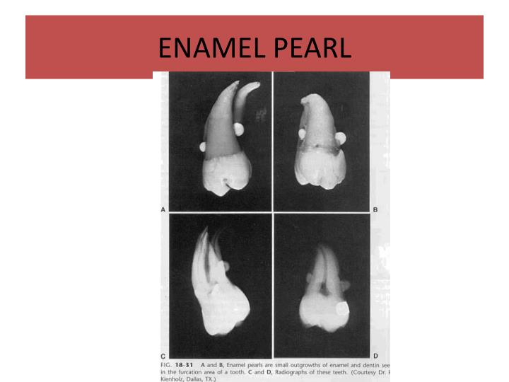 PPT - DENTAL ANOMALY PowerPoint Presentation - ID:5189746