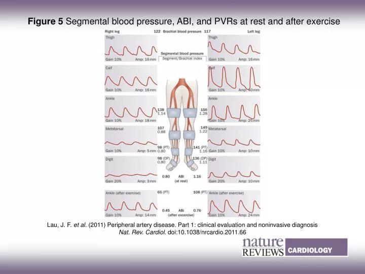 PPT - Figure 5 Segmental blood pressure, ABI, and PVRs at rest and ...