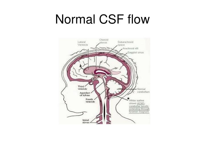 PPT - Neurology Review PowerPoint Presentation - ID:5196774
