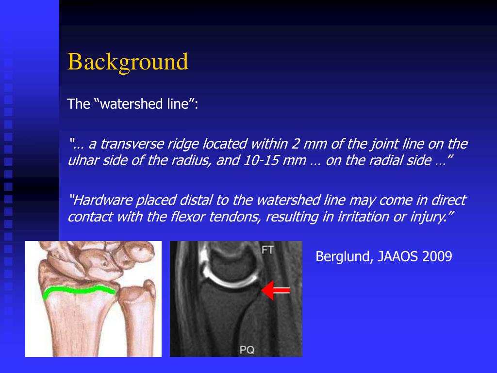 Ppt Design Specific Analysis Of Flexor Tendon Ruptures After Volar Plating Of The Distal