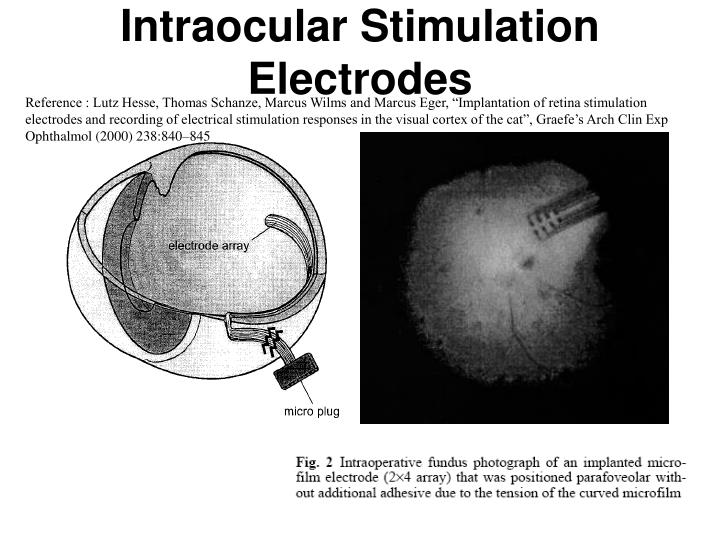 PPT - Biopotential Electrodes PowerPoint Presentation - ID:5200117