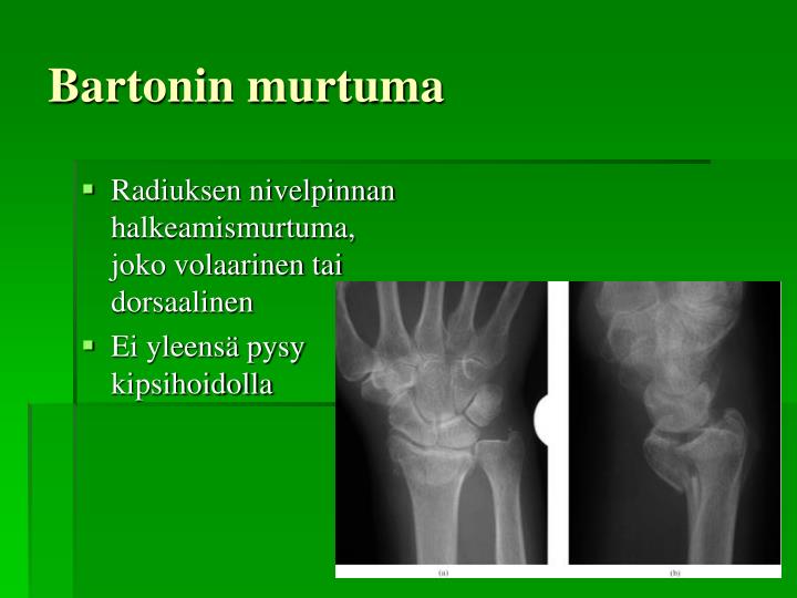 PPT - Käden alueen vammoja perusterveydenhuollon päivystyksessä ...