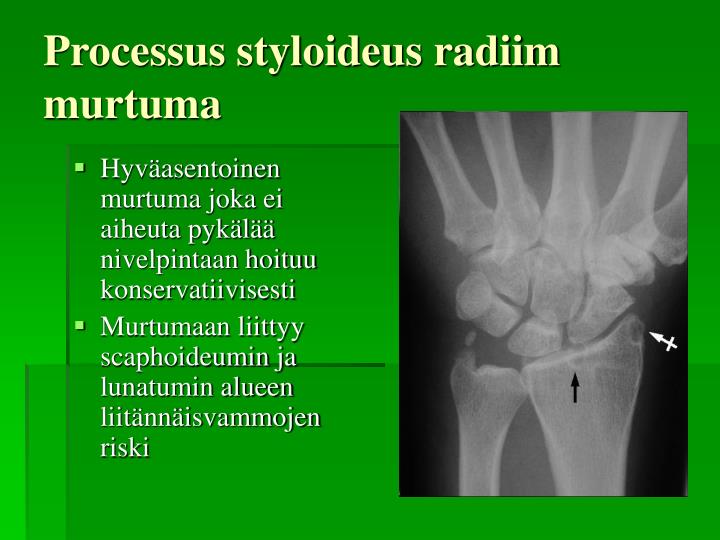 PPT - Käden alueen vammoja perusterveydenhuollon päivystyksessä ...