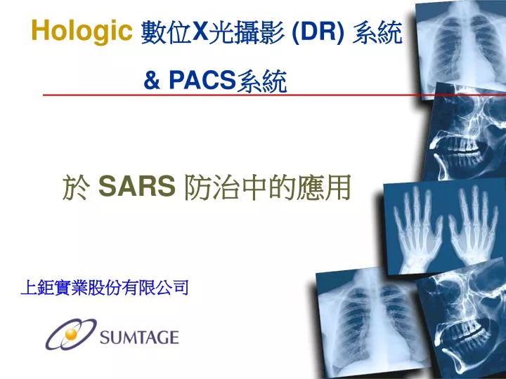 PPT - Hologic 數位 X 光攝影 ( DR) 系統 & PACS 系統 PowerPoint Presentation - ID ...