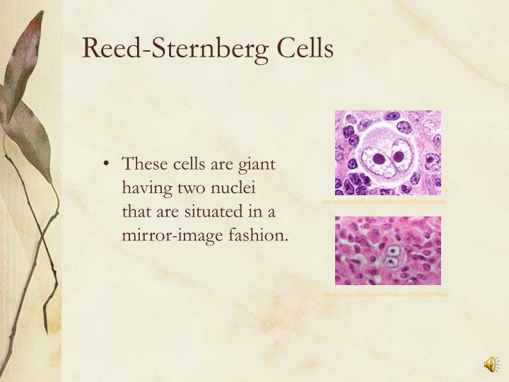 PPT - Hodgkin’s Disease PowerPoint Presentation - ID:5212104