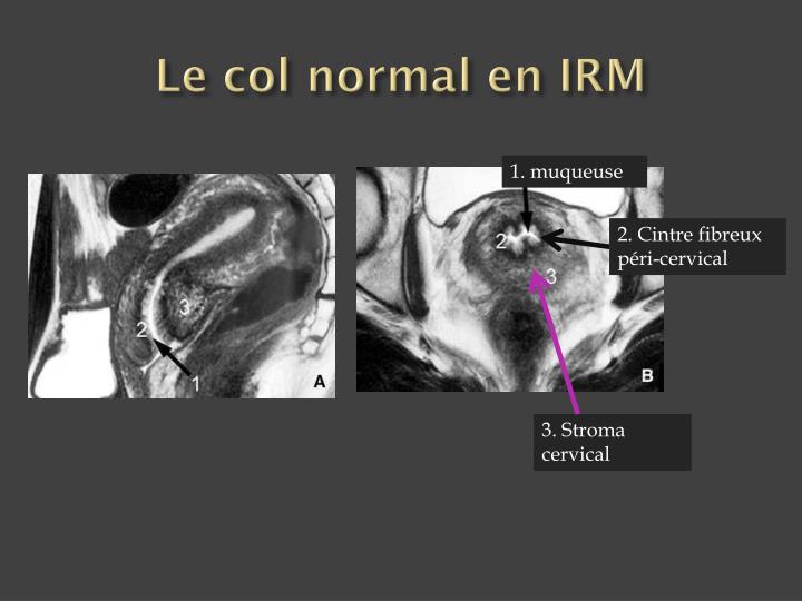 PPT - IRM PELVIENNE Pour les nuls PowerPoint Presentation - ID:5221314