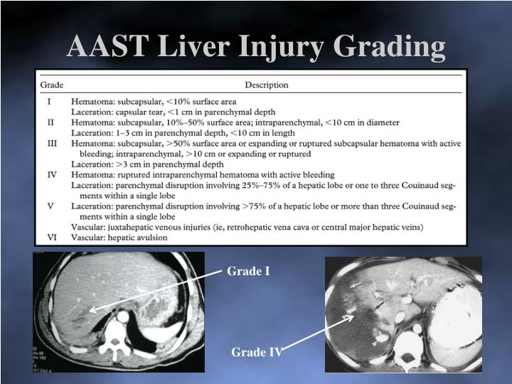 PPT - Management of Spleen/Liver Trauma PowerPoint Presentation - ID ...