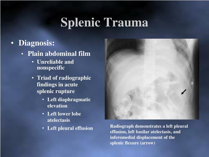 PPT - Management of Spleen/Liver Trauma PowerPoint Presentation - ID ...