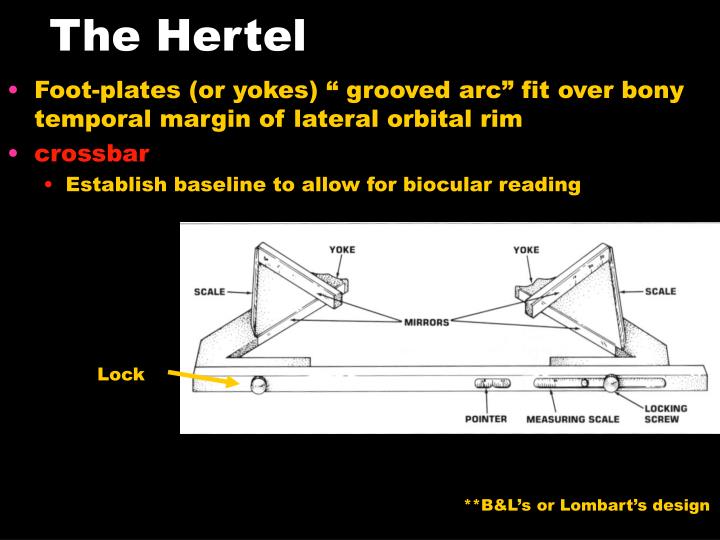 PPT - Exophthalmometry PowerPoint Presentation - ID:5238265