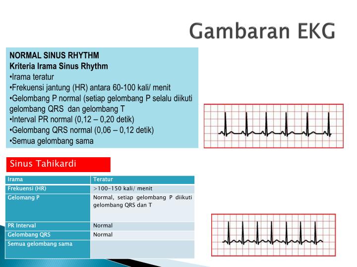 PPT - DASAR-DASAR EKG PowerPoint Presentation - ID:5248059