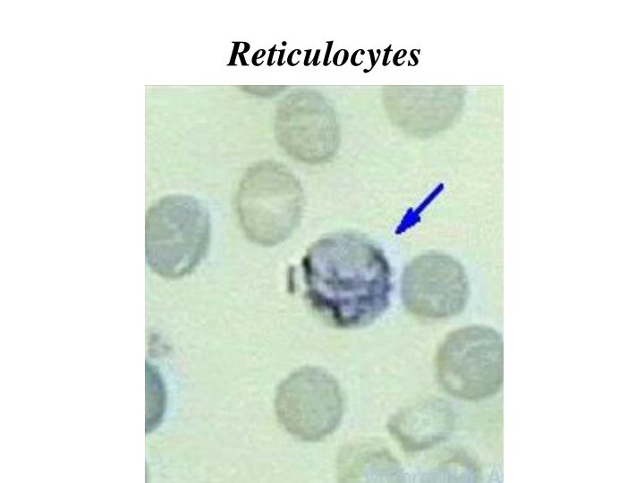 PPT - Complete Blood Count (CBC) PowerPoint Presentation - ID:5258057