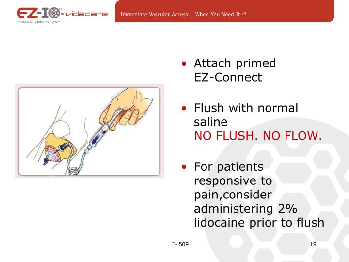PPT - EZ-IO in the Pediatric Patient PowerPoint Presentation - ID:5260305