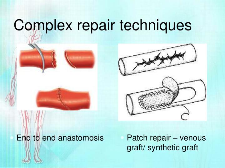 PPT - Vascular trauma in extremities PowerPoint Presentation - ID:5262582