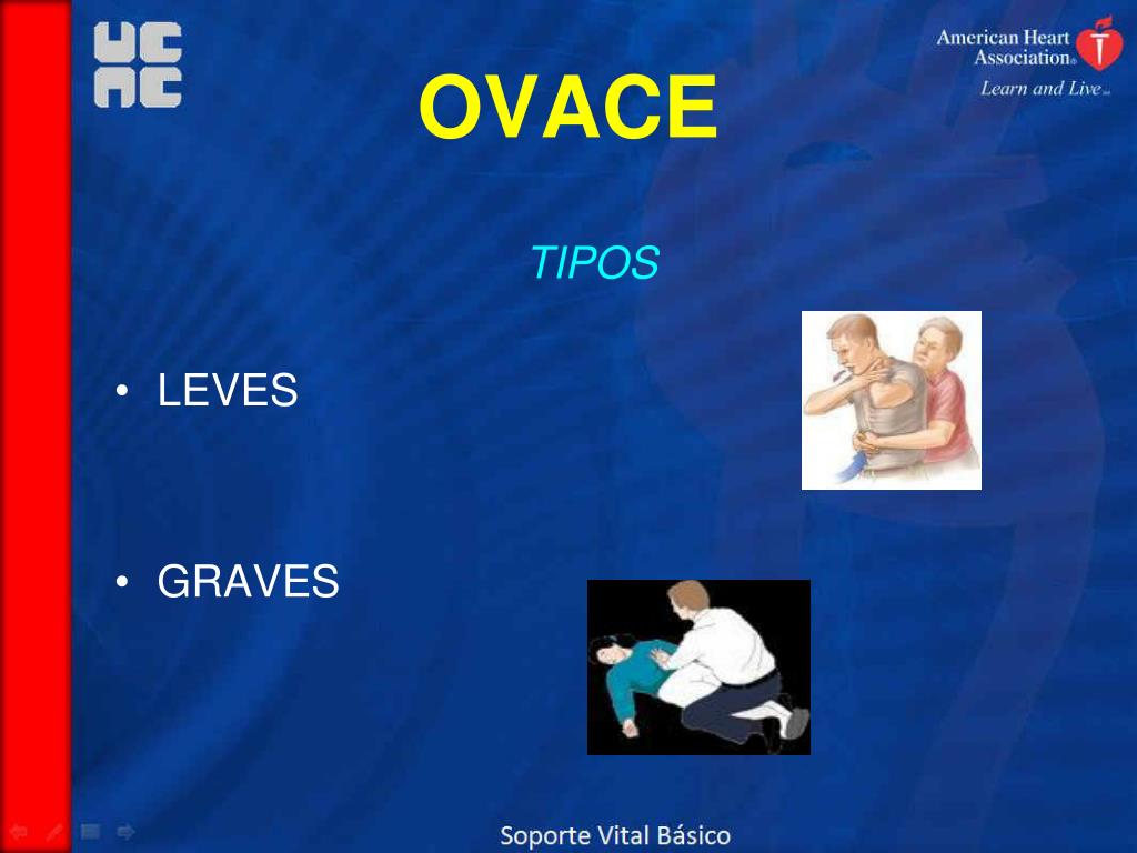 PPT - OVACE OBSTRUCCIÓN DE LA VÍA AÉREA POR CUERPO EXTRAÑO PowerPoint ...
