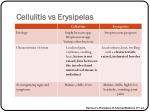 PPT - Carbuncle with Ipsilateral Facial Cellulitis in a Diabetic ...