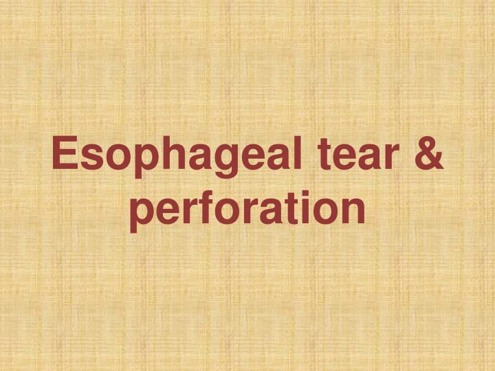 PPT - Diseases of Esophagus & Dysphagia PowerPoint Presentation - ID ...