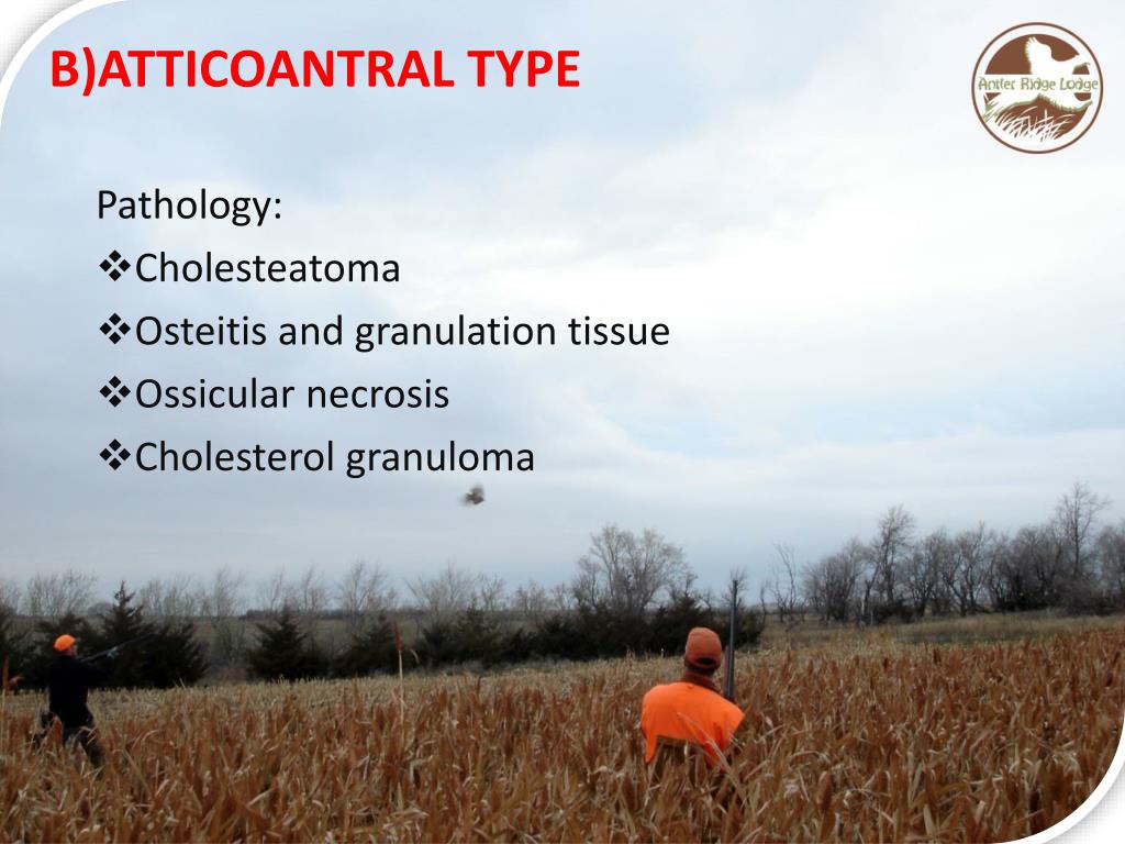 PPT - Cholesteatoma and chronic suppurative otitis media PowerPoint ...