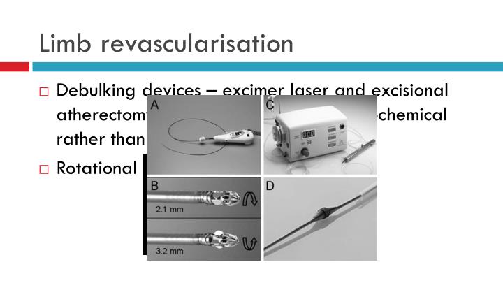 PPT - Interventional radiology Dr. M. A. Baradia PowerPoint ...