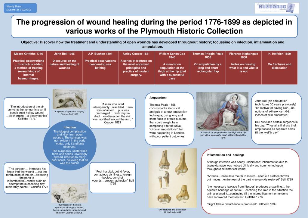 PPT - Evolution of Wound Healing: 1776-1899 PowerPoint Presentation ...