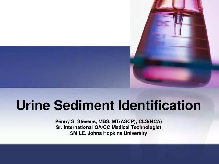PPT - Urine Sediment Identification PowerPoint Presentation, free ...