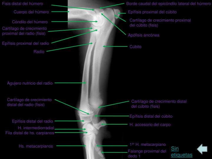 PPT - Radiología del Perro: miembro torácico PowerPoint Presentation ...