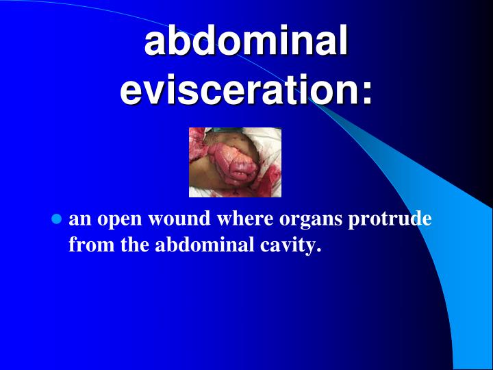 PPT - abandonment: PowerPoint Presentation - ID:5303536